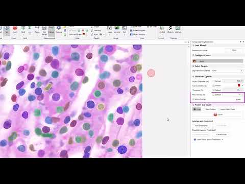 Finding Objects with StarDist Models | Media Cybernetics, Inc.