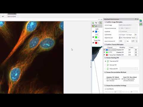 AutoQuant Deconvolution | Media Cybernetics, Inc.